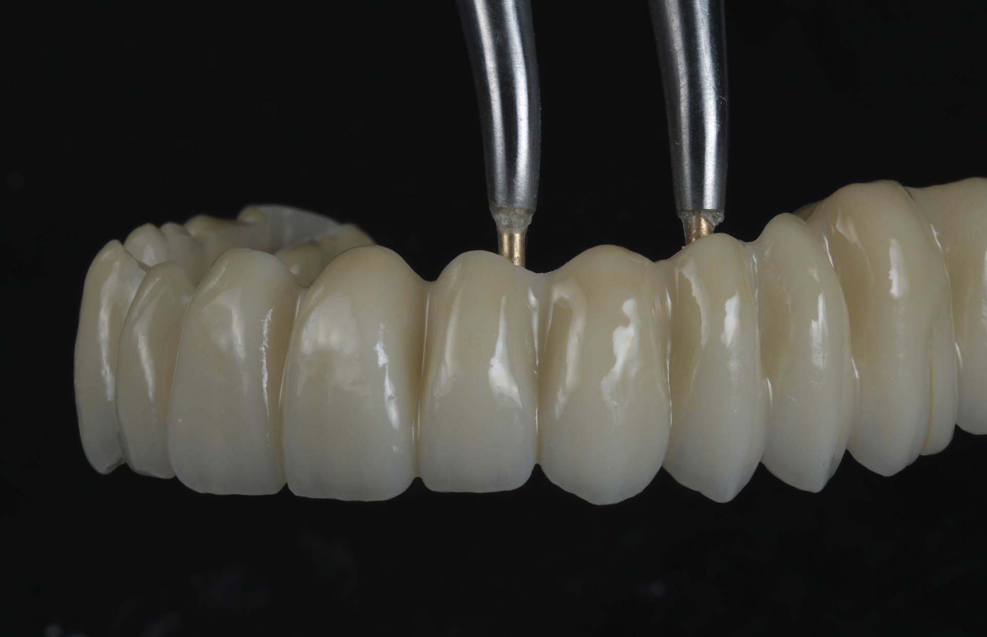 Prótesis Dental de Zirconio | Dental Designer 3D